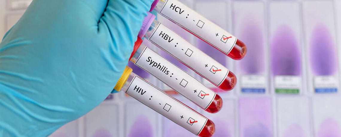 When You Get Blood Work Done Do They Test For Stds Cured Journal 